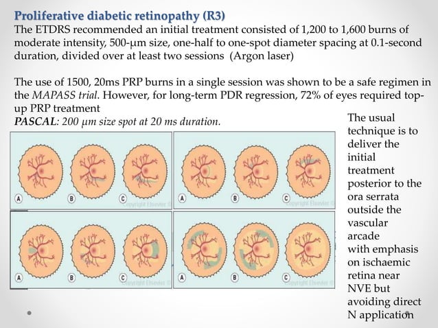 DIABETIC RETINOPATHY.pptx ophthalmological | PPT DIABETIC RETINOPATHY.pptx ophthalmological | PPT