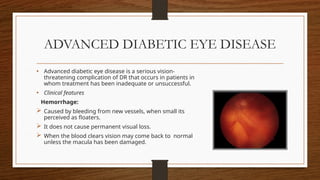 DIABETIC RETINOPATHY Ophthalmology PGjr1 | PPTX