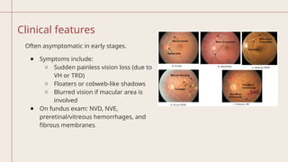 Diabetic Retinopathy.................... | PPTX