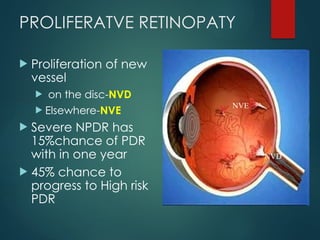 Diabetic Retinopathy - epidemiology, pathogenesis and clinical features ...