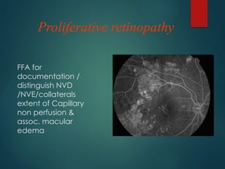 Diabetic Retinopathy - epidemiology, pathogenesis and clinical features ...