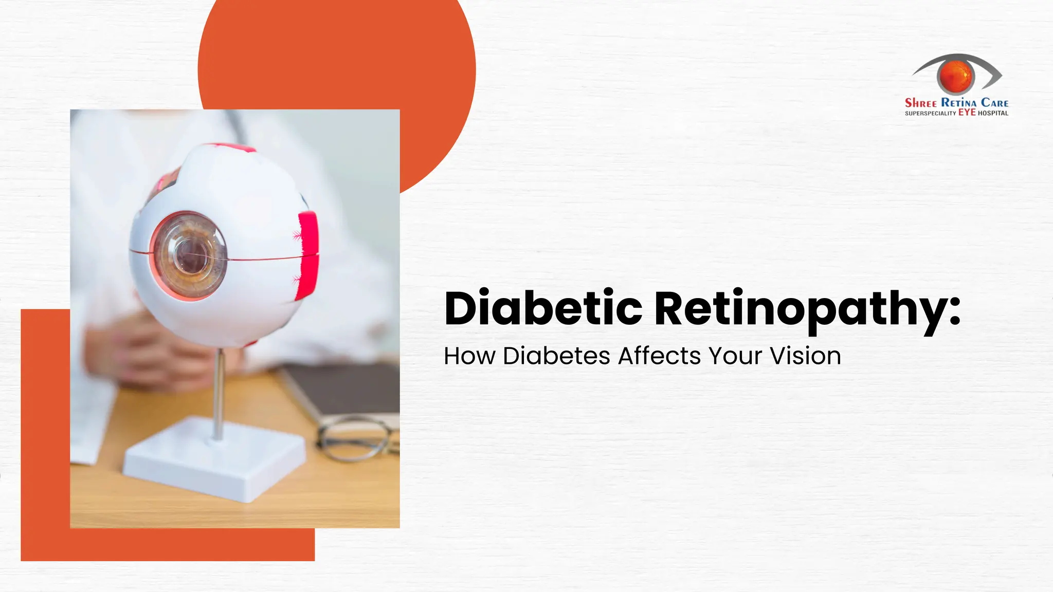 Diabetic Retinopathy - How Diabetes Affects Your Vision | PDF