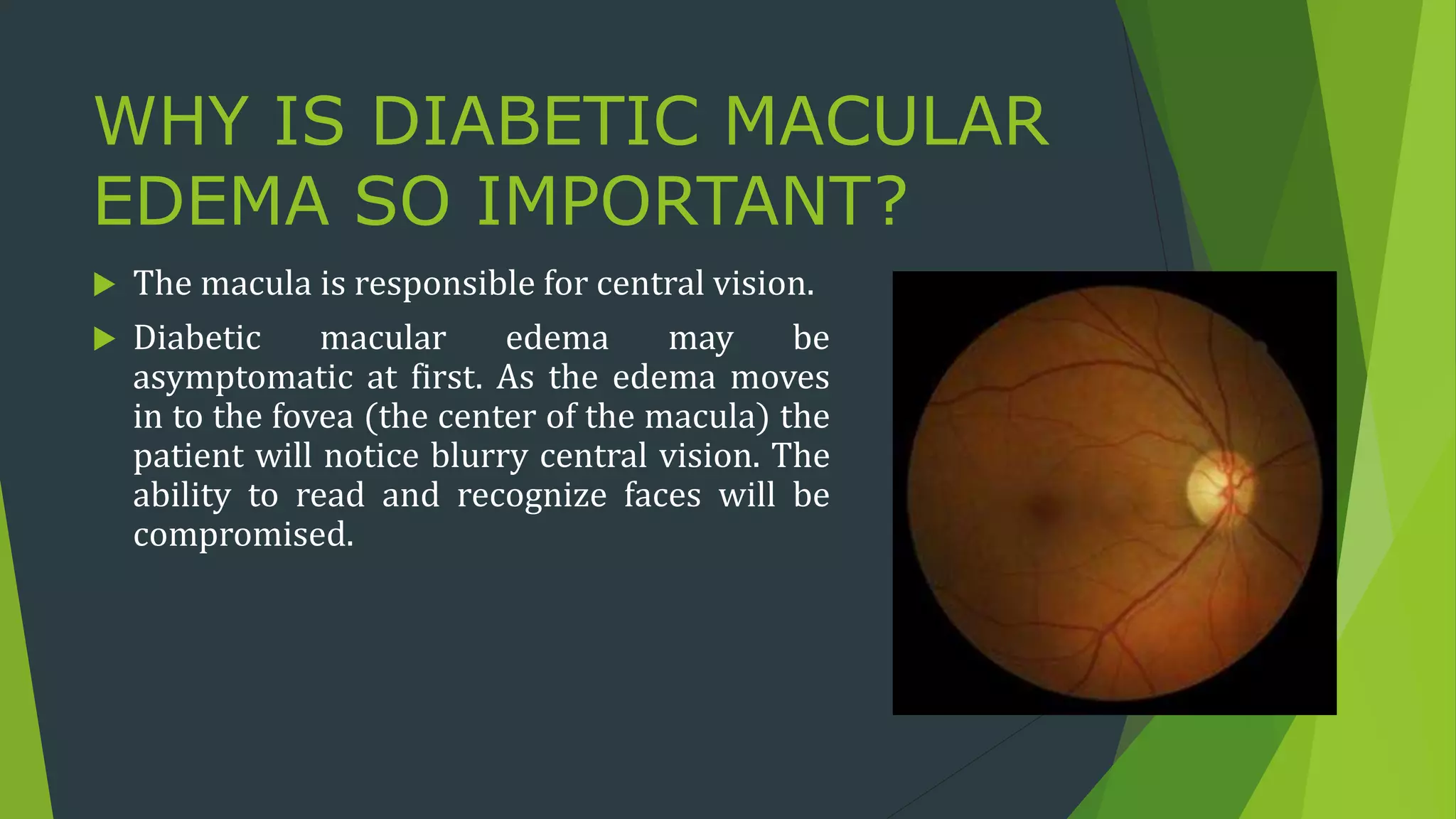 Diabetic Retinopathy- PDR and CSME | PPTX