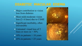 Diabetic Retinopathy Basics.pptx