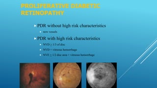 Diabetic Retinopathy Basics.pptx