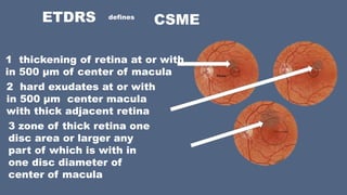DIABETIC RETINOPATHY DEMYSTIFIED | PPTX | Eye and Vision Conditions ...