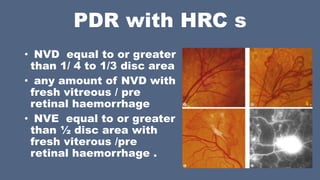 DIABETIC RETINOPATHY DEMYSTIFIED | PPT