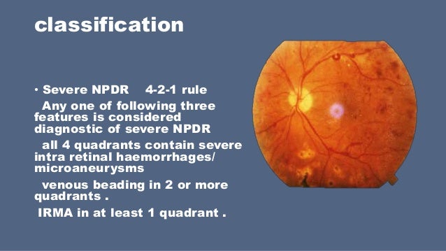 DIABETIC RETINOPATHY DEMYSTIFIED