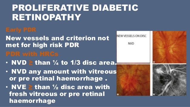 DIABETIC RETINOPATHY DEMYSTIFIED
