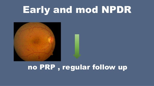 DIABETIC RETINOPATHY DEMYSTIFIED