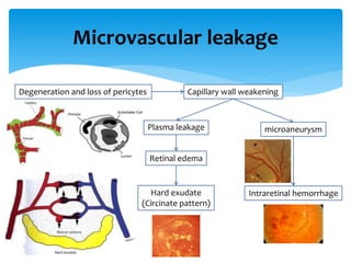 Screening of Diabetic Retinopathy | PPT