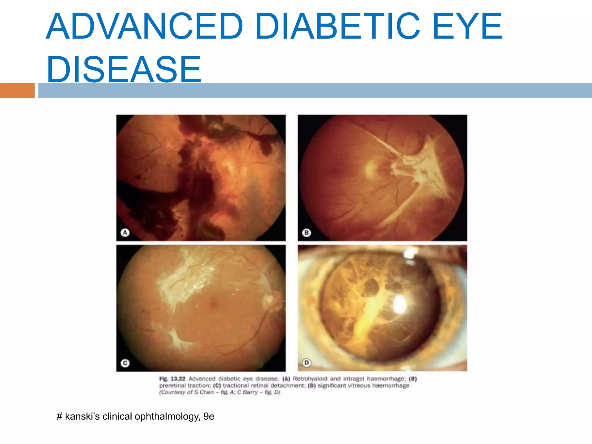 DIABETIC RETINOPATHY .pptx