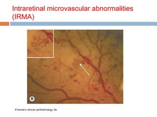 DIABETIC RETINOPATHY .pptx