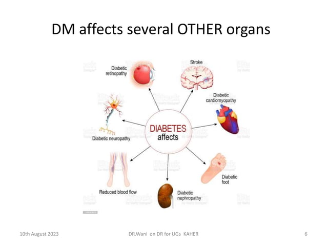 DR VIVEK WANI TALK ON DIABETIC RETINOPATHY FOR KLE MBBS STUDENTS UG ...