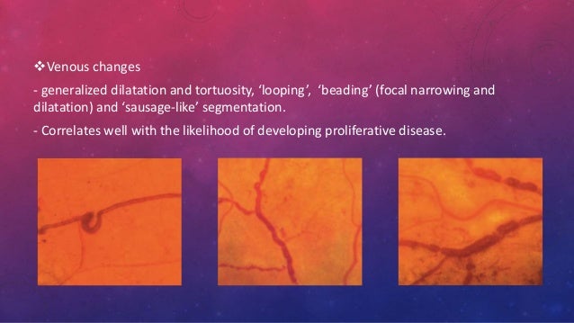 Diabetic retinopathy