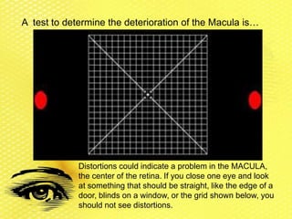 Diabetic retinopathy group 7 period 2 new 4 | PPT