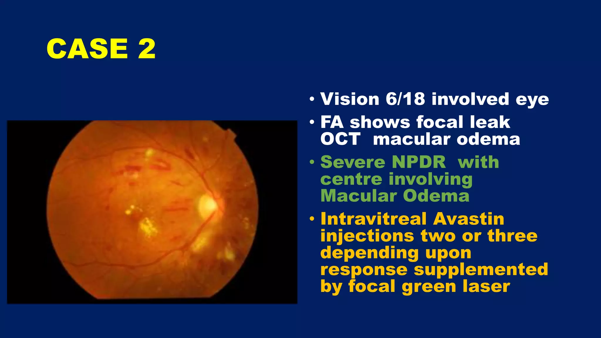Diabetic retinopathy management | PPTX