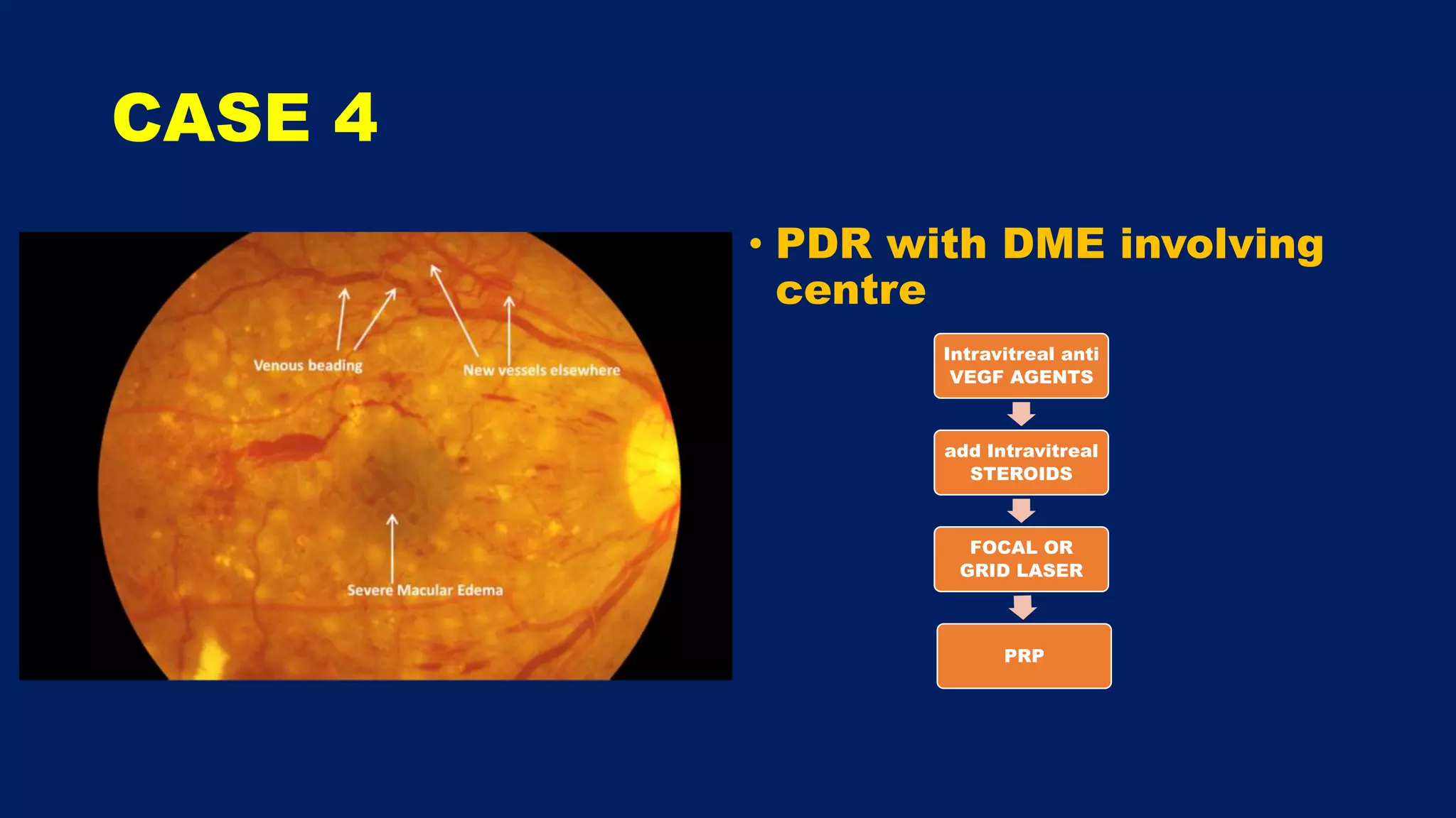 Diabetic retinopathy management | PPTX