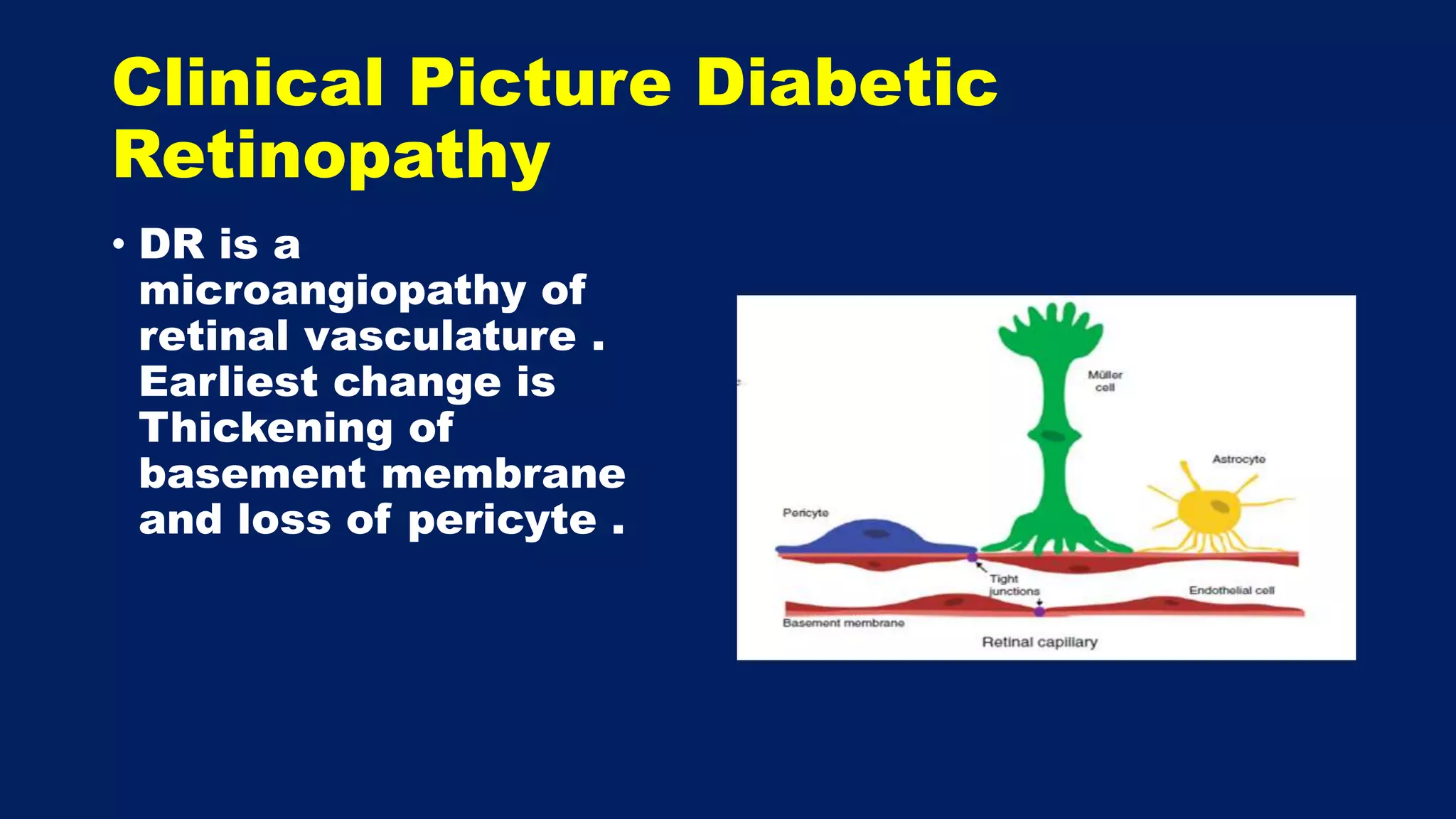Diabetic retinopathy management | PPTX