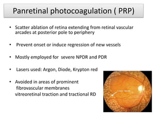 Diabetic retinopathy- Management | PPTX