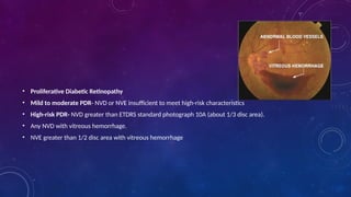 SCREENING FOR DIABETIC RETINOPATHY .pptx