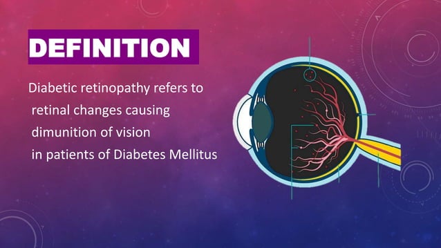 Diabetic Retinopathy .pptx