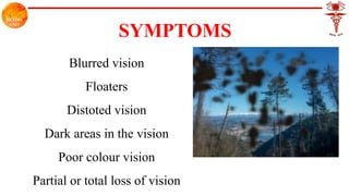 Diabetic retinopathy, causes, pathogenesis and treatment | PPTX