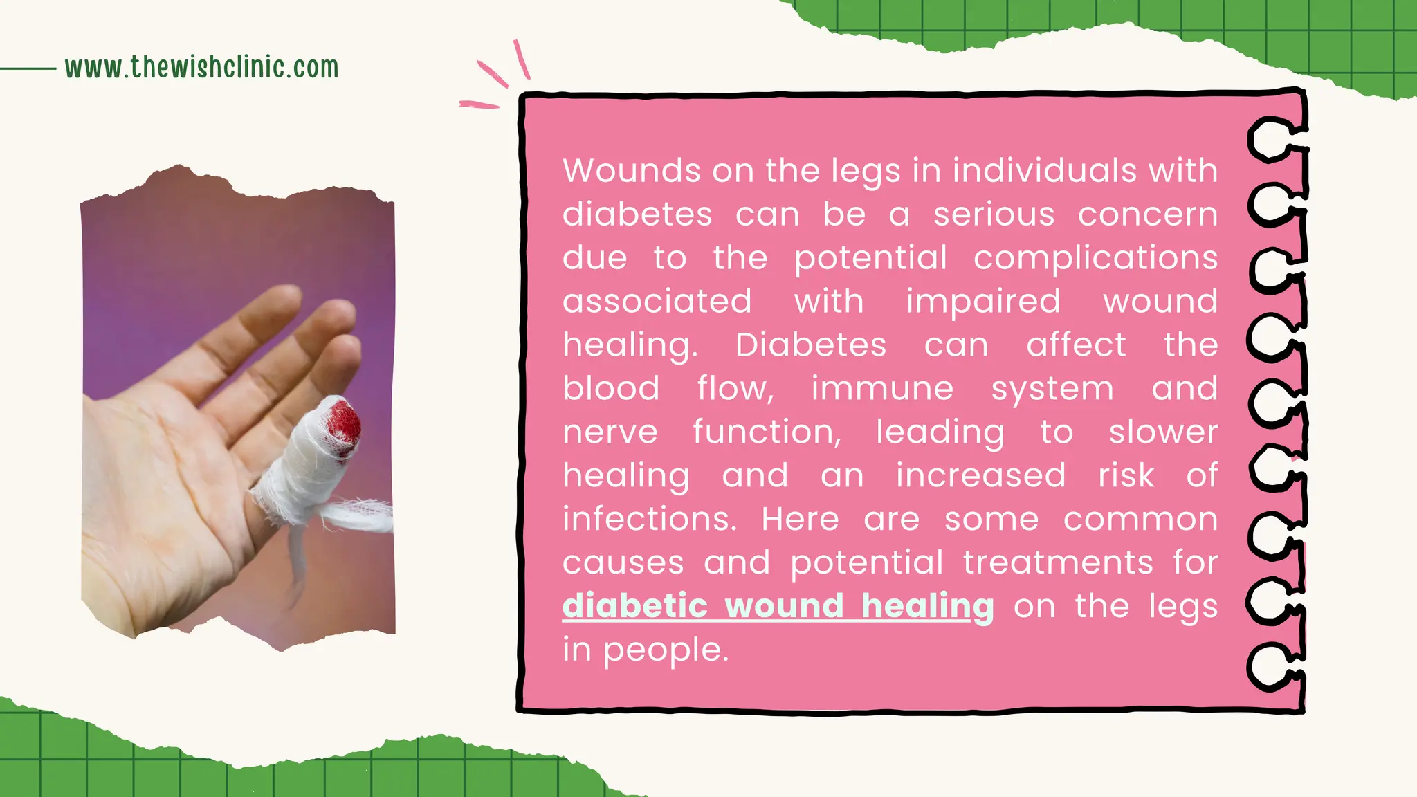 Diabetic Wound Healing | PDF
