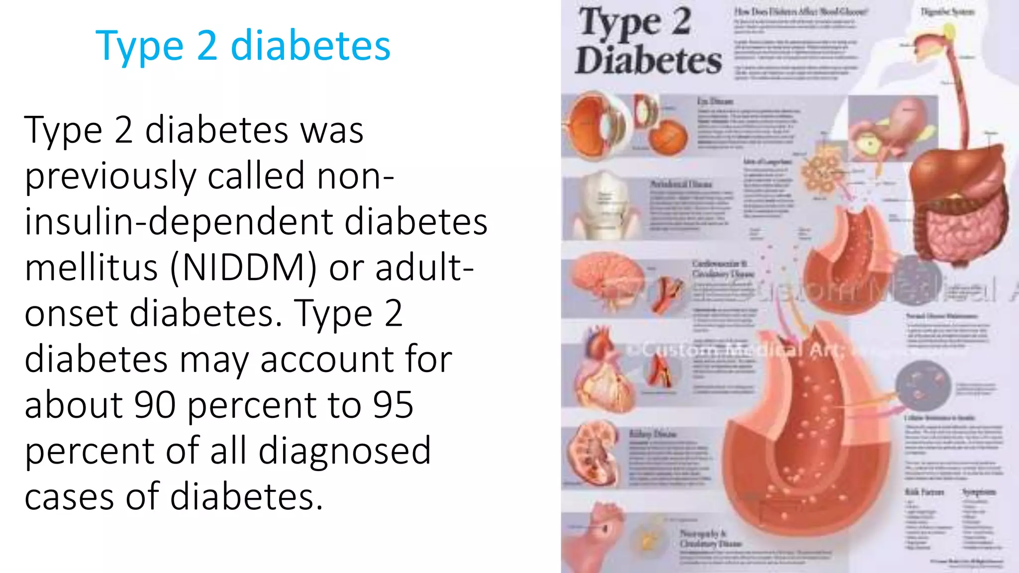 Diabets | PPTX