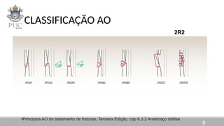 DIAFISE DO ANTEBRAÇO ANATOMIA CLASIFICACION | PPTX