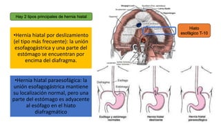 Diafragma | PPTX