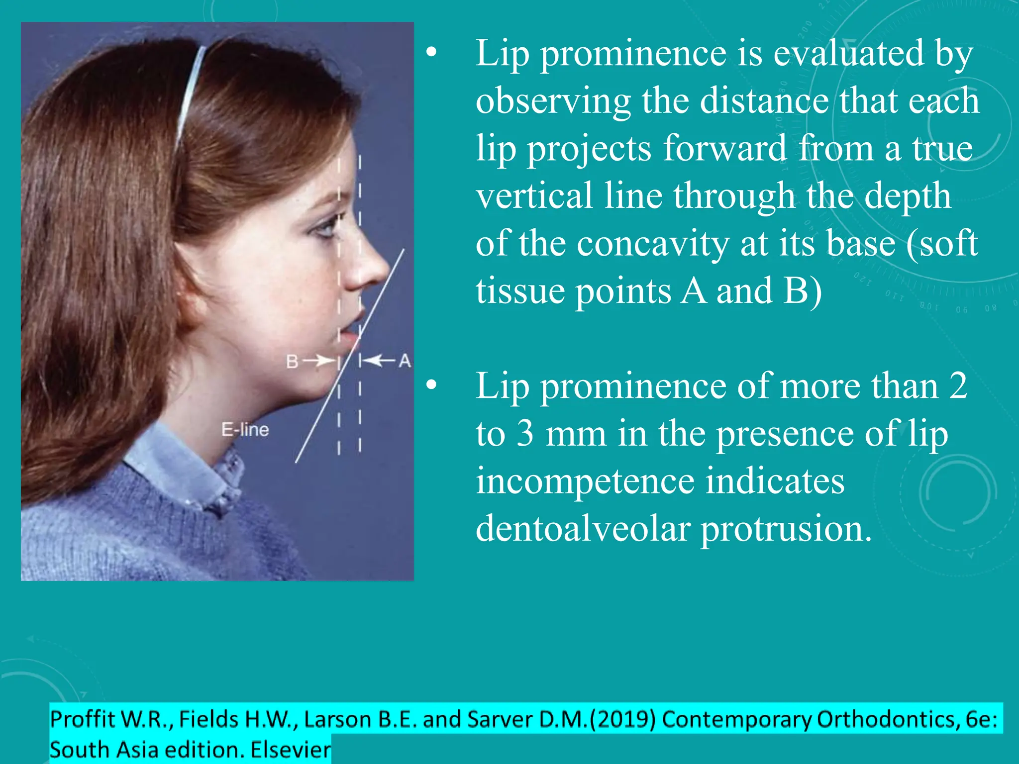 DIAGNOSIS and TREATMENT PLANNING IN ORTHODONTICS | PPTX