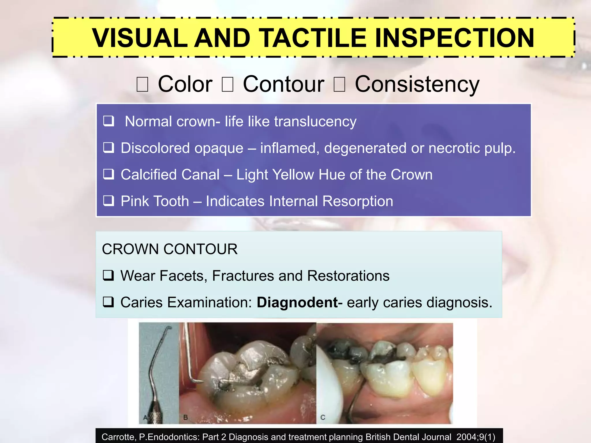 CLINICAL DIAGNOSIS OF ENDODONTIC PATHOSIS | PPT