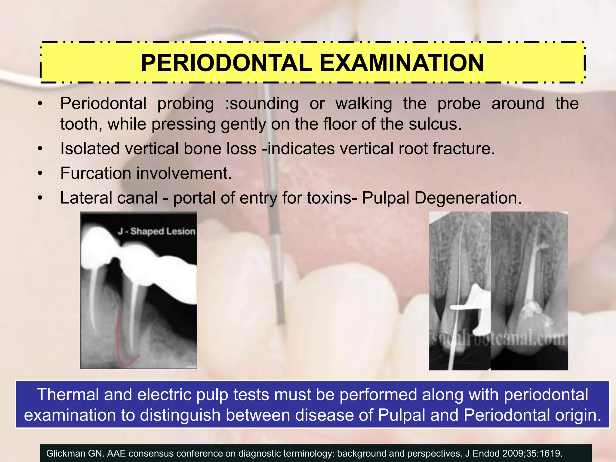 CLINICAL DIAGNOSIS OF ENDODONTIC PATHOSIS | PPT