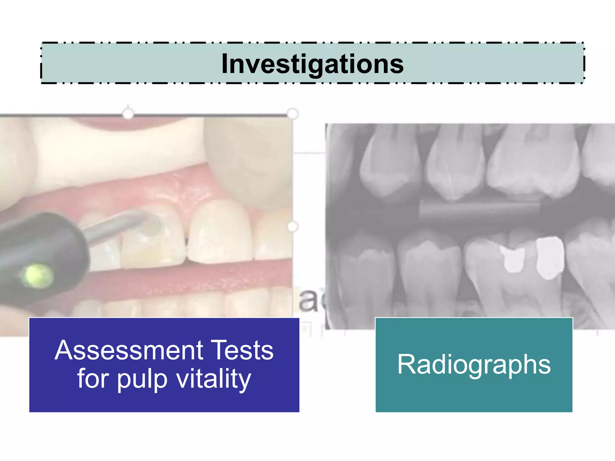 CLINICAL DIAGNOSIS OF ENDODONTIC PATHOSIS | PPT | Dental Health ...