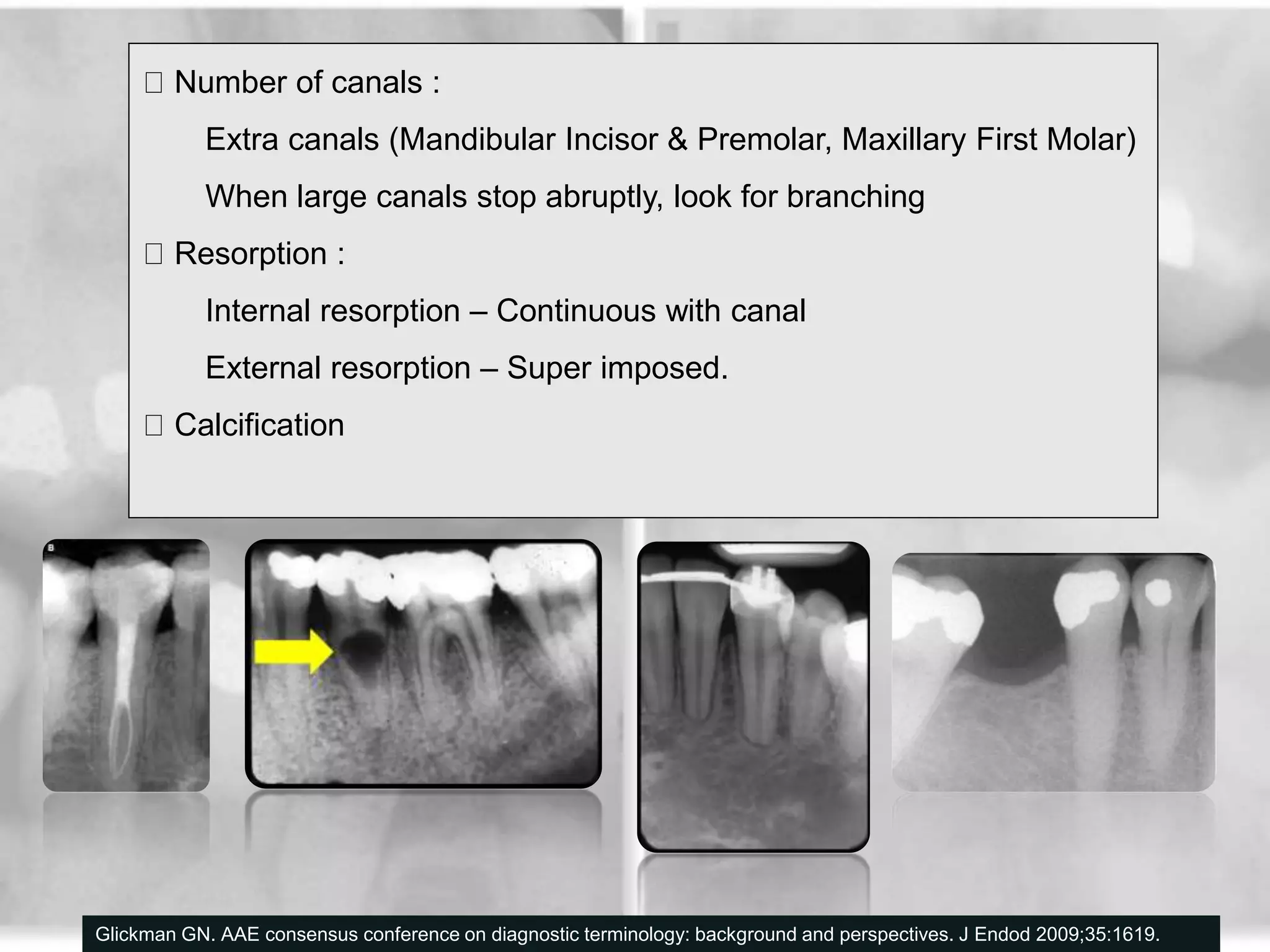 CLINICAL DIAGNOSIS OF ENDODONTIC PATHOSIS | PPT