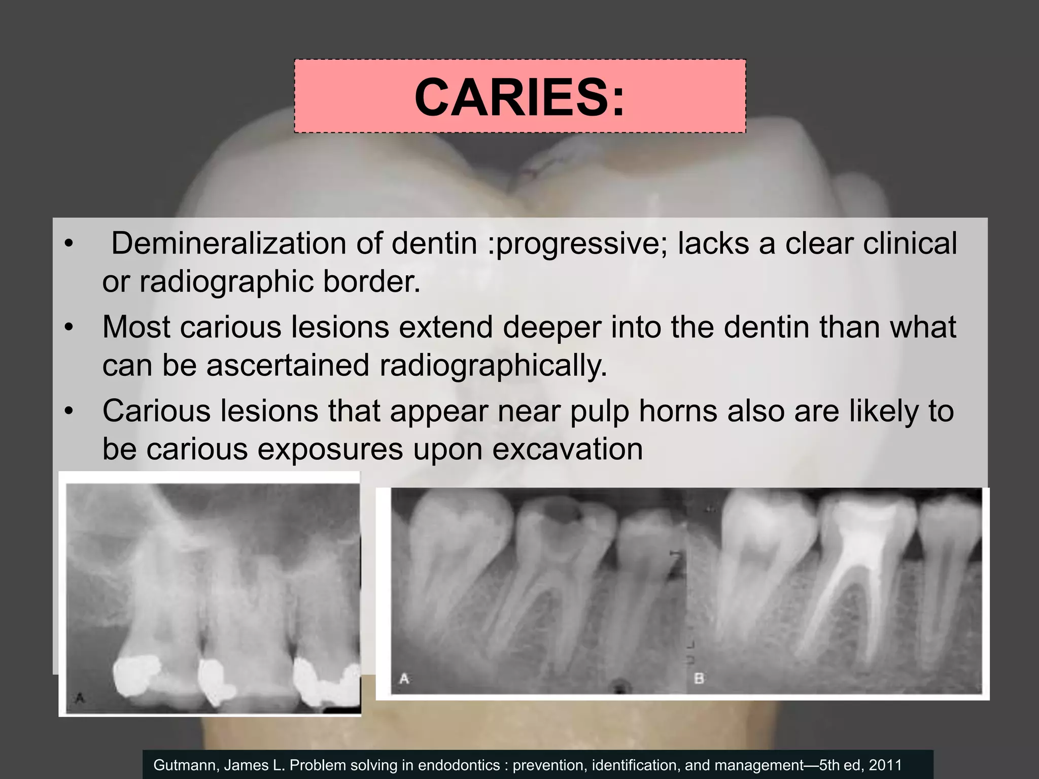 CLINICAL DIAGNOSIS OF ENDODONTIC PATHOSIS | PPT