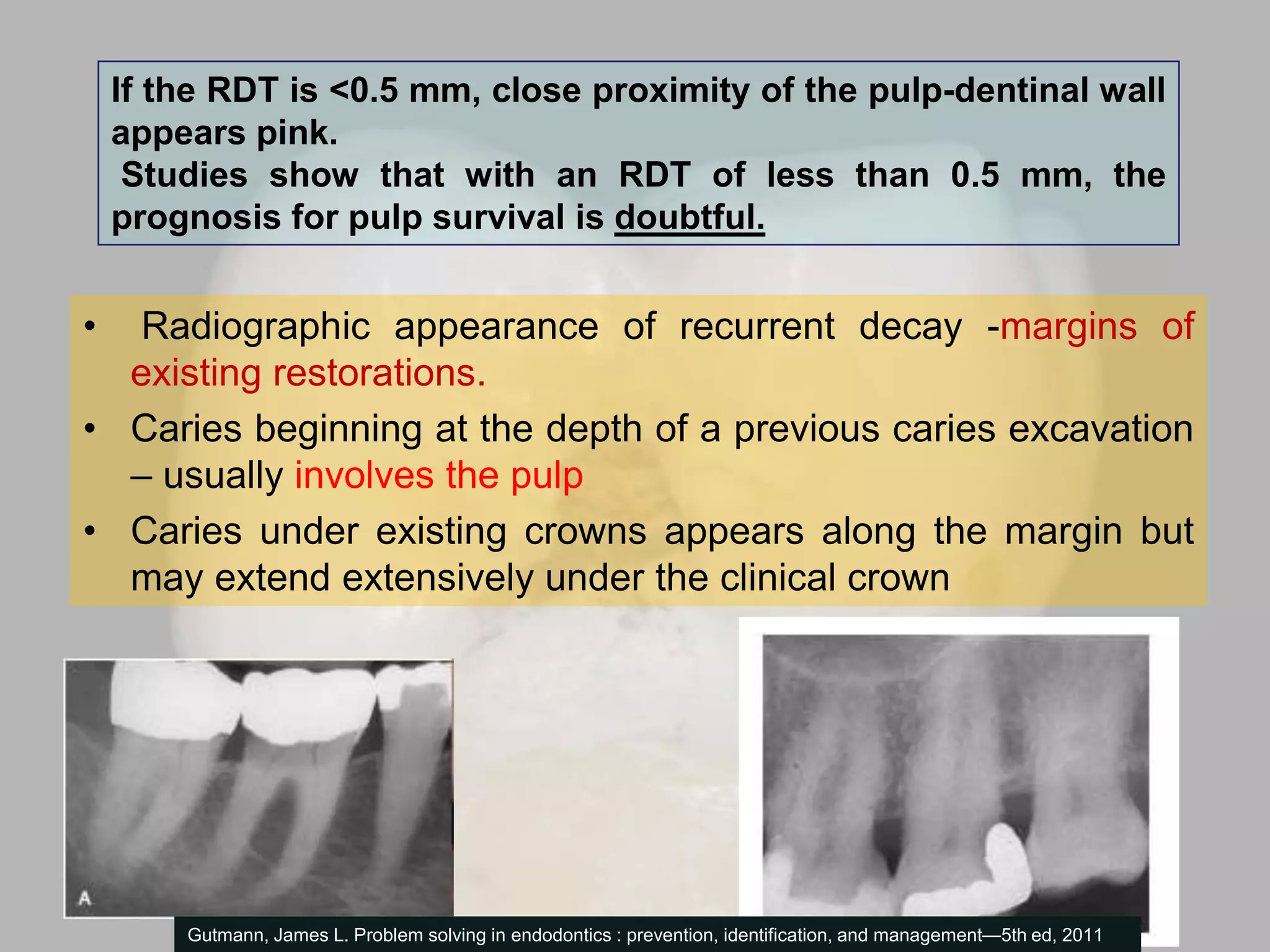 CLINICAL DIAGNOSIS OF ENDODONTIC PATHOSIS | PPT