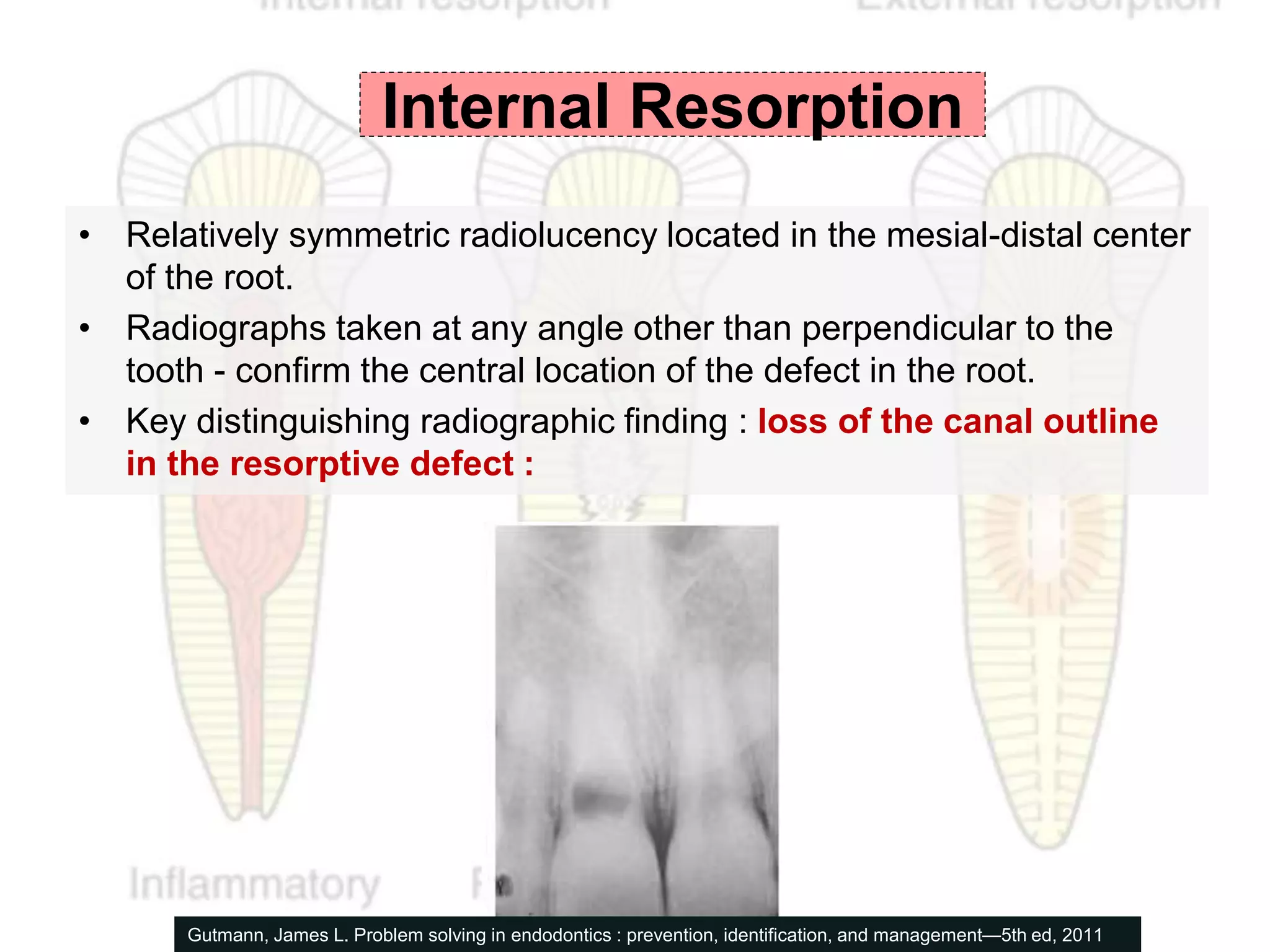 CLINICAL DIAGNOSIS OF ENDODONTIC PATHOSIS | PPT