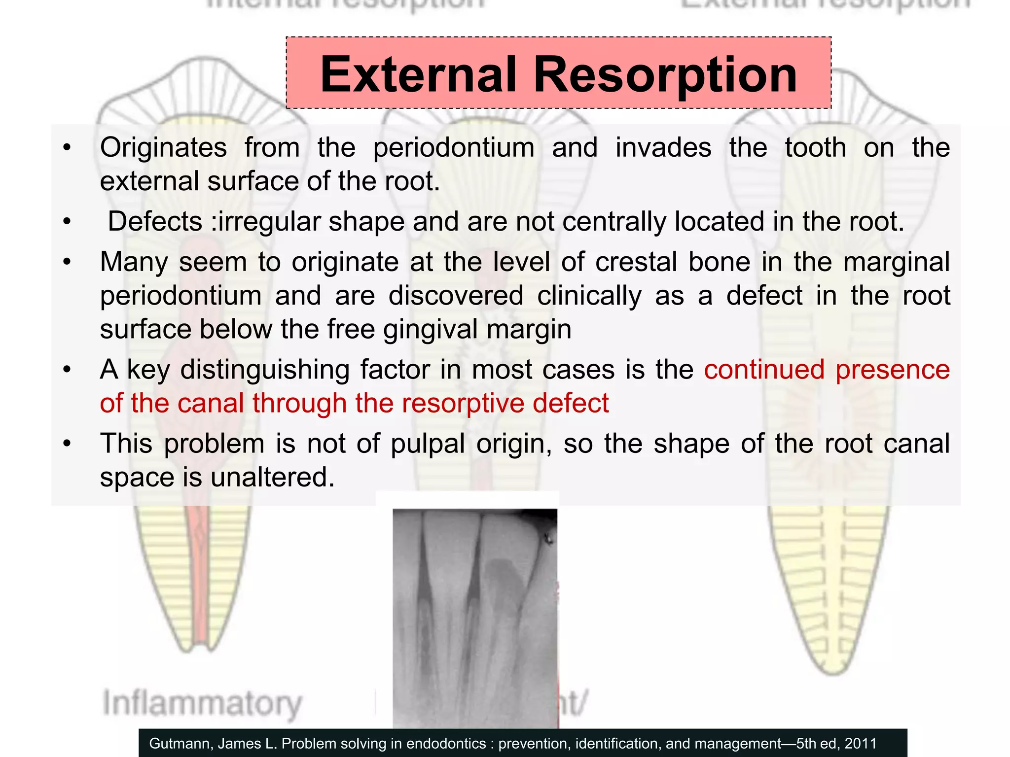 CLINICAL DIAGNOSIS OF ENDODONTIC PATHOSIS | PPT