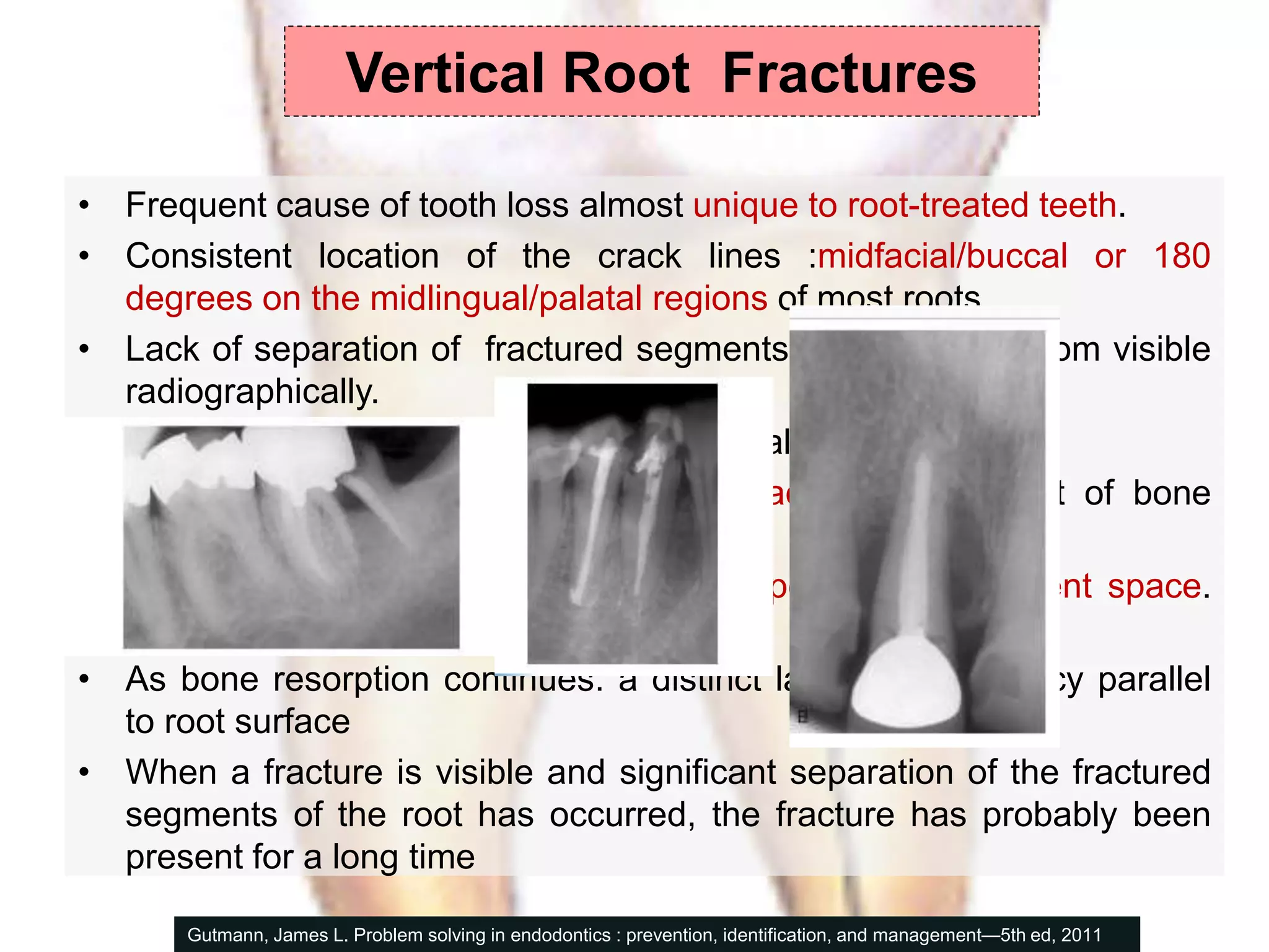 CLINICAL DIAGNOSIS OF ENDODONTIC PATHOSIS | PPT