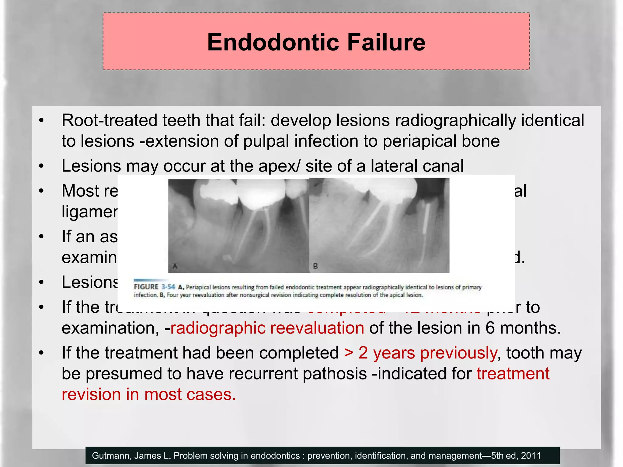 CLINICAL DIAGNOSIS OF ENDODONTIC PATHOSIS | PPT