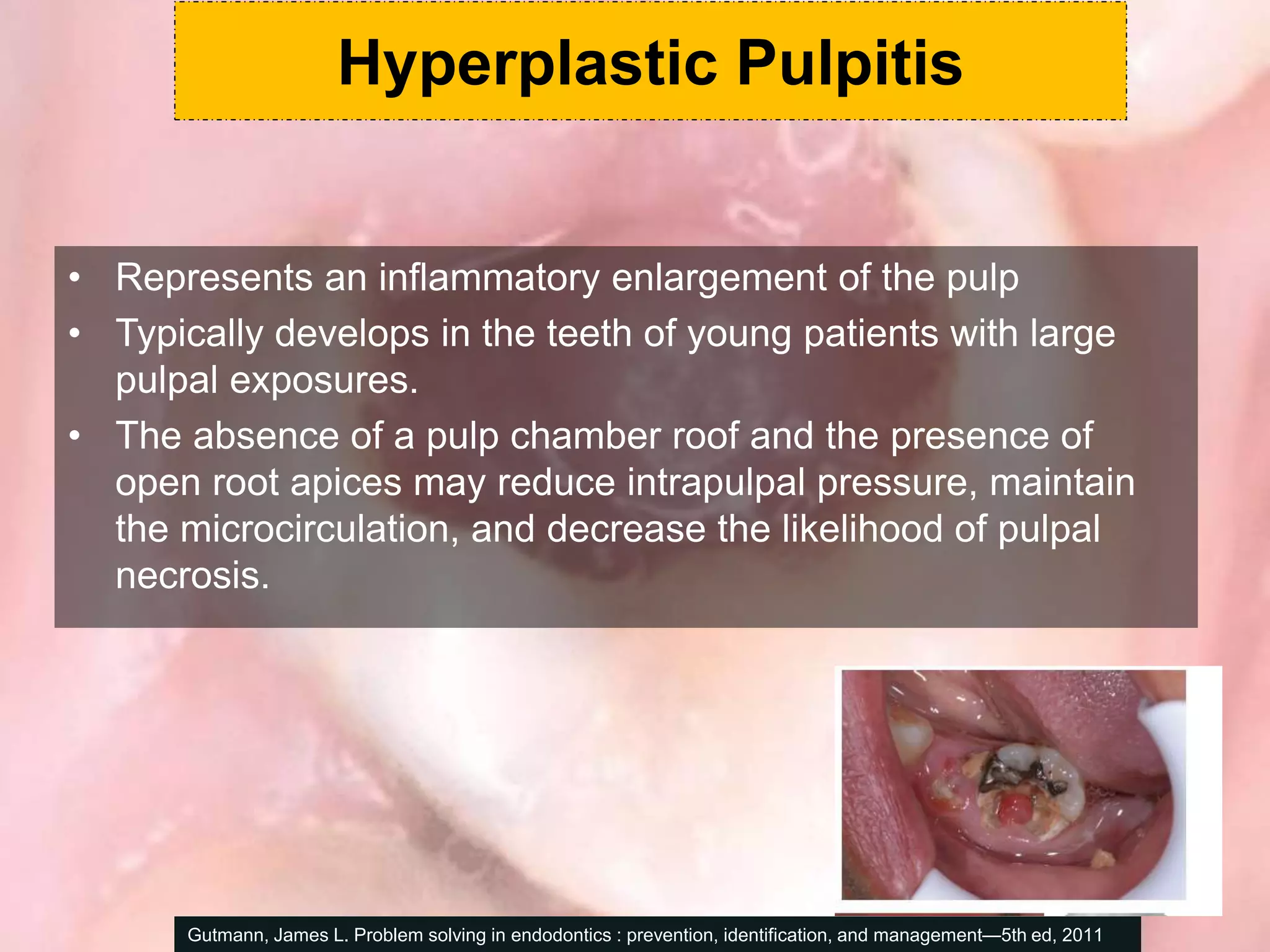 CLINICAL DIAGNOSIS OF ENDODONTIC PATHOSIS | PPT