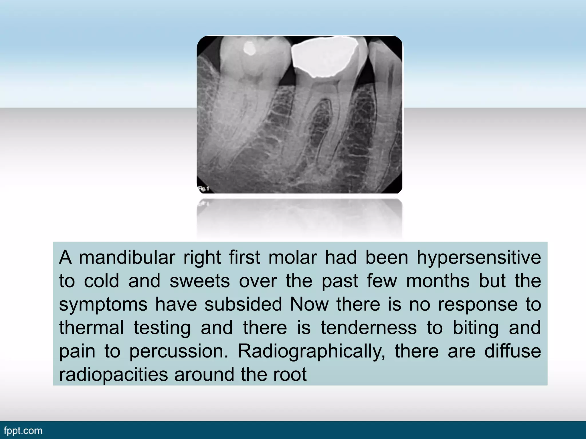 CLINICAL DIAGNOSIS OF ENDODONTIC PATHOSIS | PPT