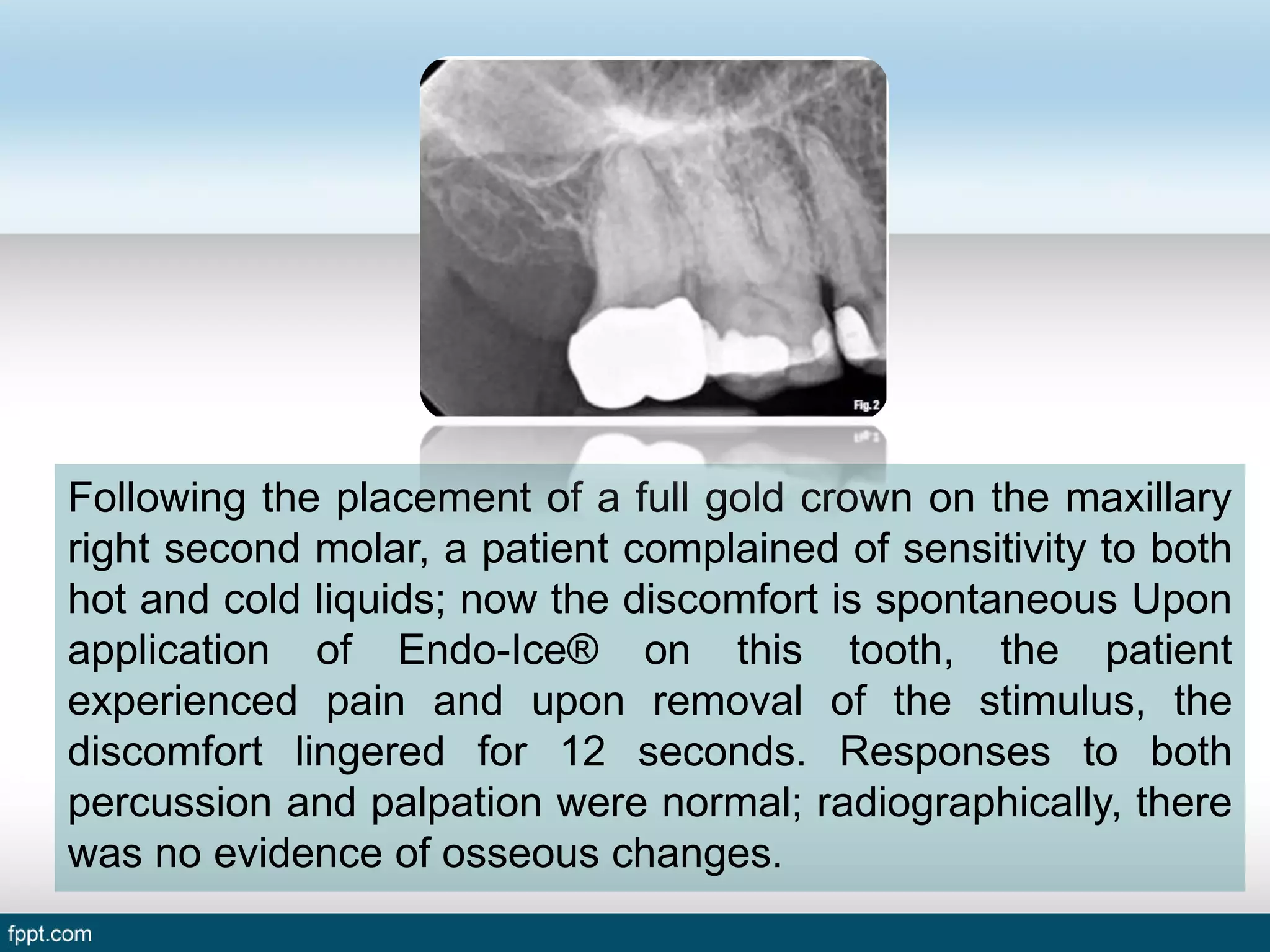 CLINICAL DIAGNOSIS OF ENDODONTIC PATHOSIS | PPT