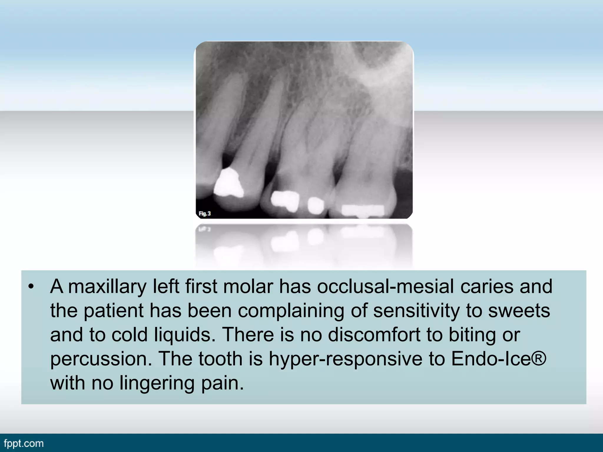 CLINICAL DIAGNOSIS OF ENDODONTIC PATHOSIS | PPT