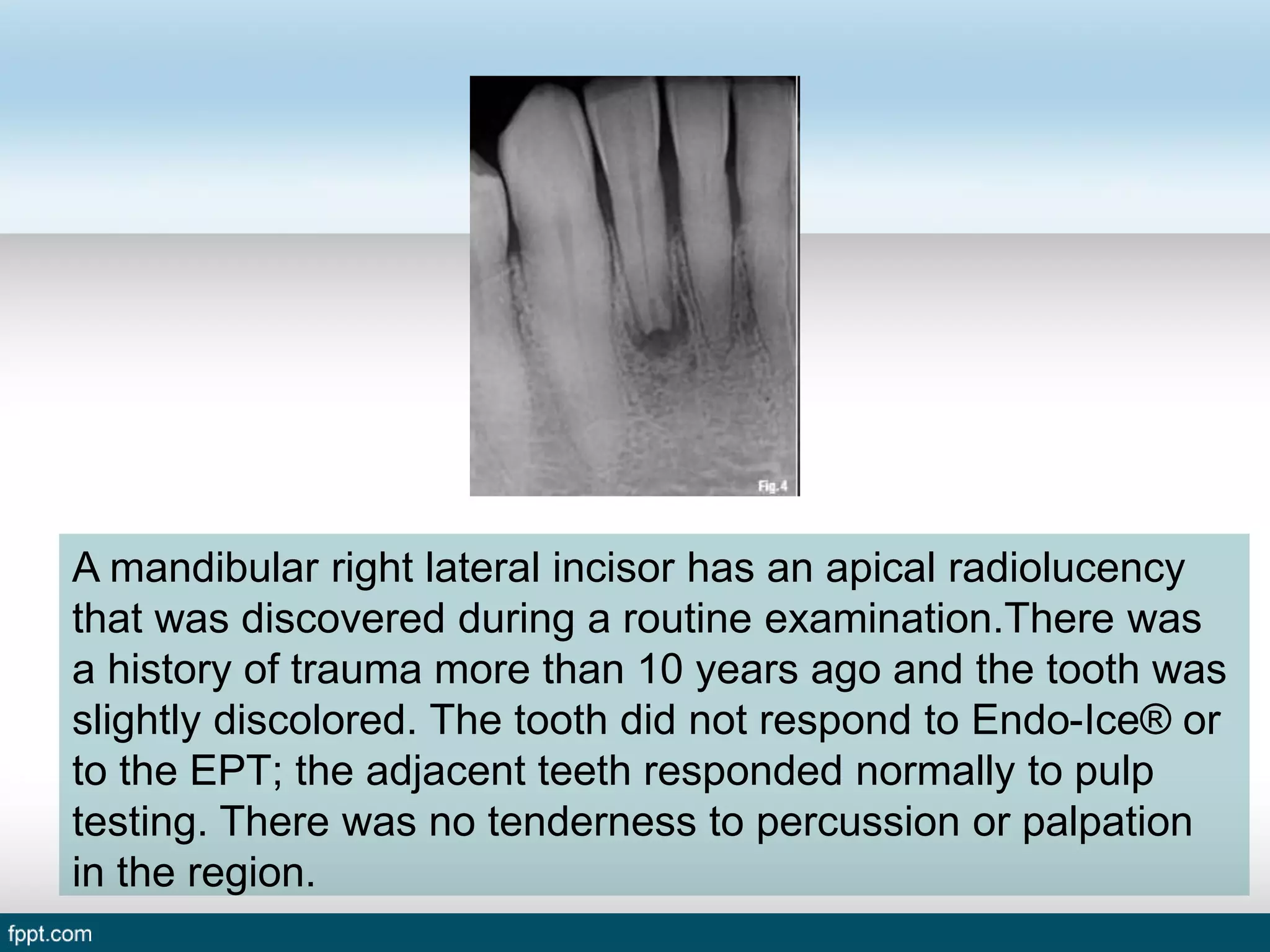 CLINICAL DIAGNOSIS OF ENDODONTIC PATHOSIS | PPT