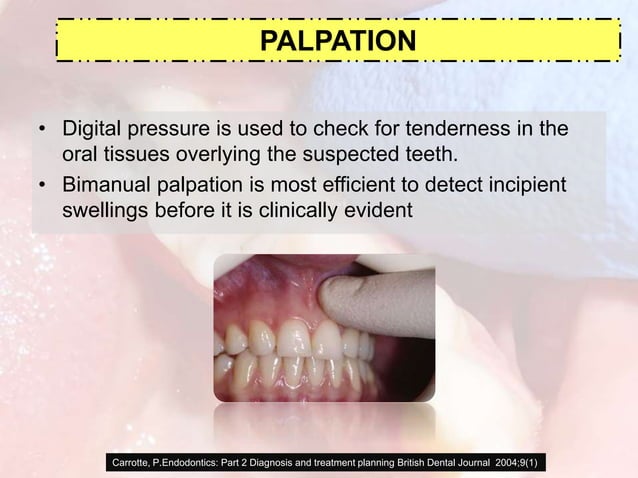 CLINICAL DIAGNOSIS OF ENDODONTIC PATHOSIS | PPT | Dental Health ...