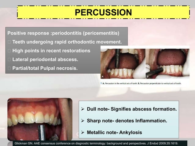 CLINICAL DIAGNOSIS OF ENDODONTIC PATHOSIS | PPT | Dental Health ...