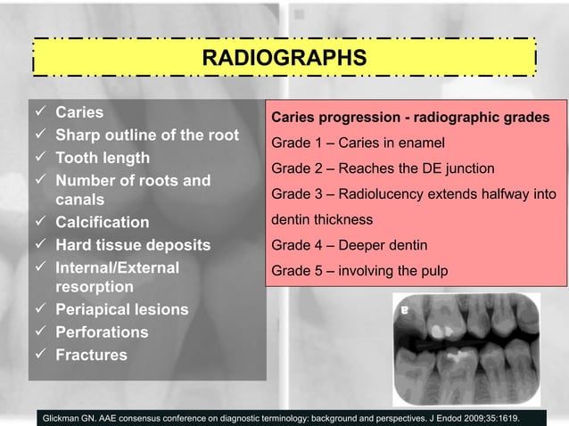 CLINICAL DIAGNOSIS OF ENDODONTIC PATHOSIS | PPT | Dental Health ...